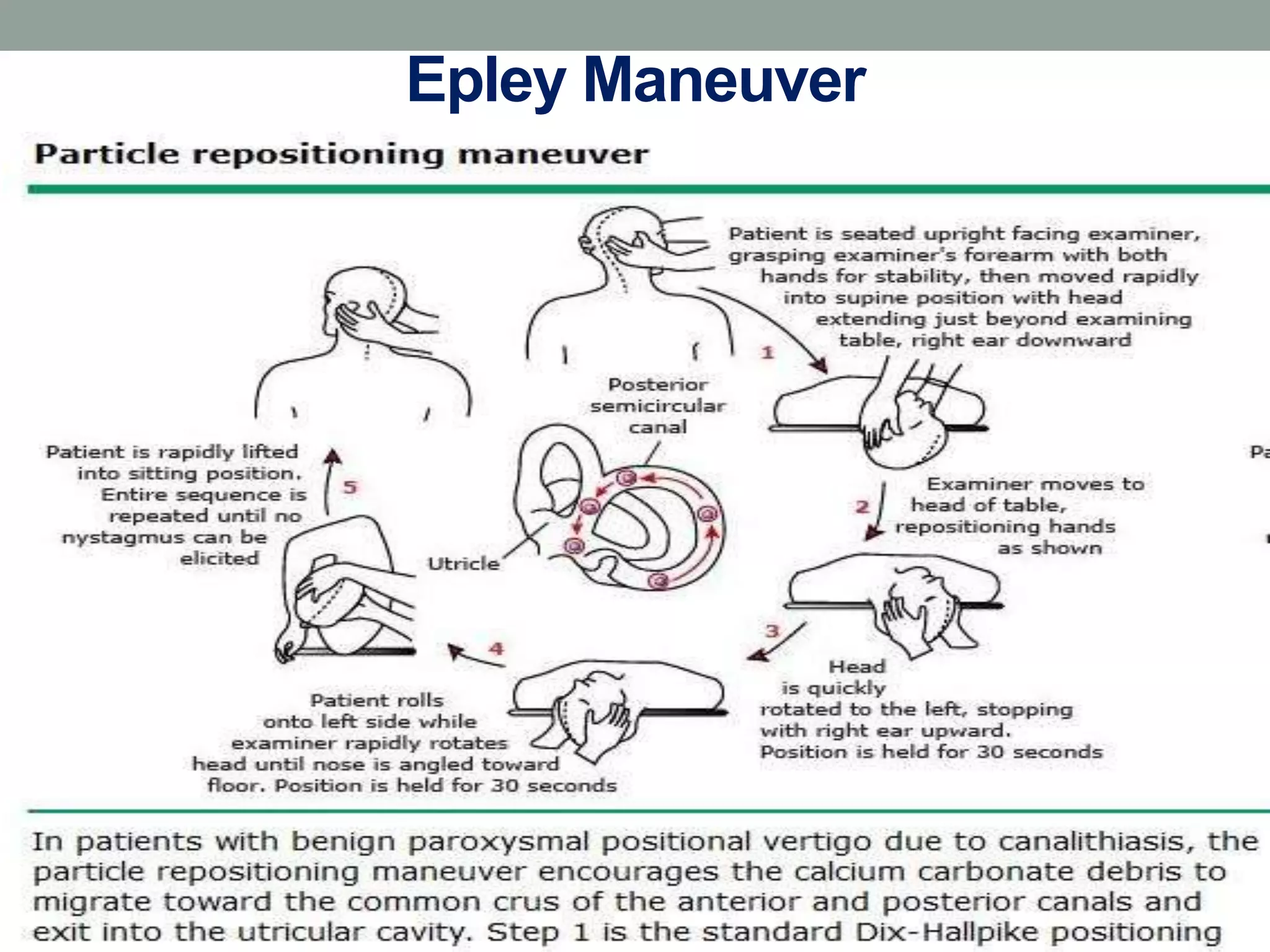 Benign Paroxysmal Positional Vertigo (BPPV) | PPTX