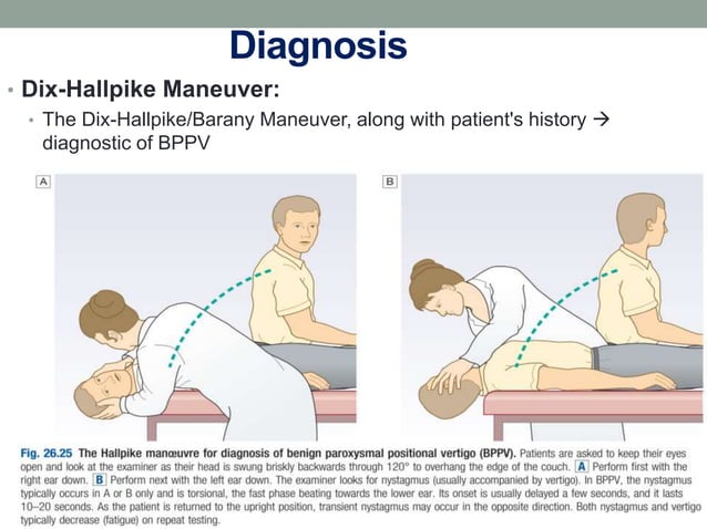 Benign Paroxysmal Positional Vertigo (BPPV)