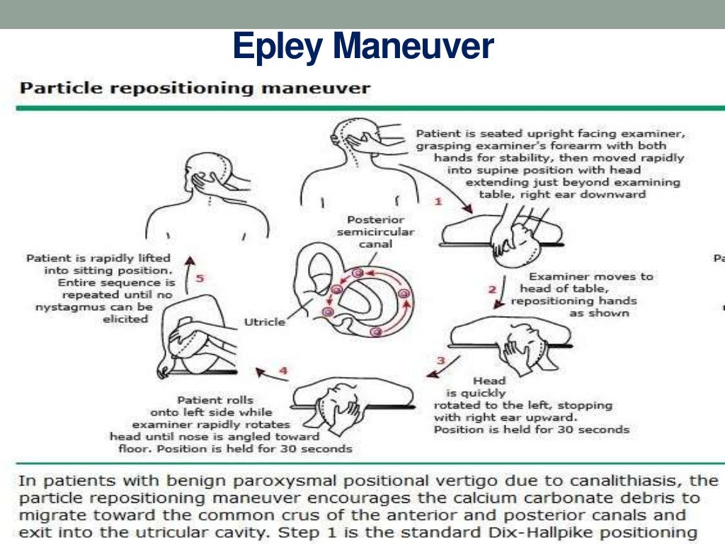 Benign Paroxysmal Positional Vertigo (BPPV)