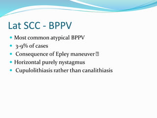 BPPV | PPTX