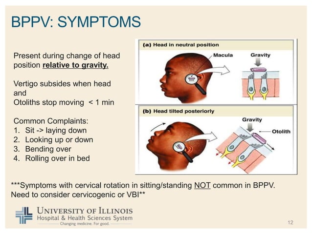 Bppv final -grand rounds sept 2015 | PPTX | Eye and Vision Conditions ...