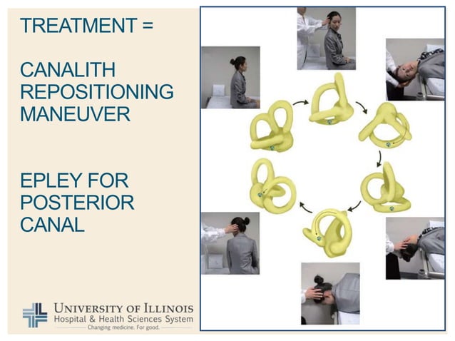 Bppv final -grand rounds sept 2015 | PPTX | Eye and Vision Conditions ...