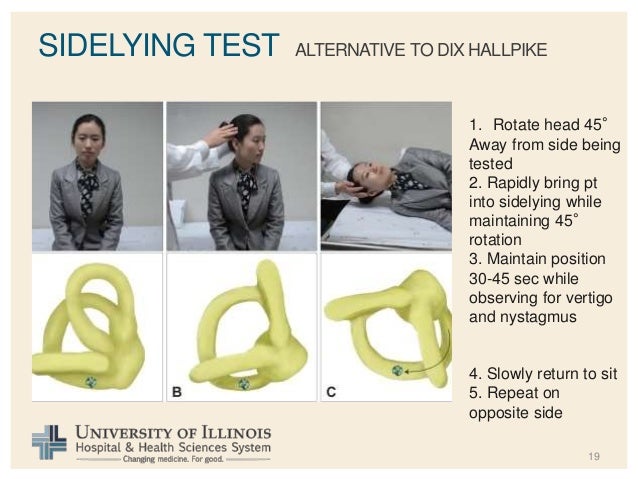 Bppv final -grand rounds sept 2015