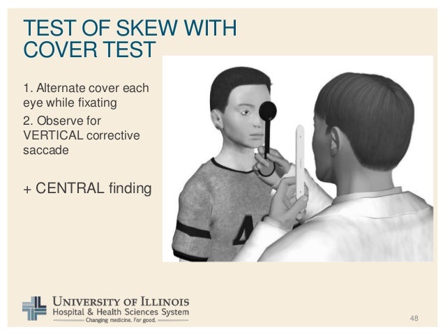 Bppv final -grand rounds sept 2015