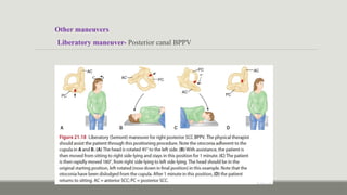 BPPV( Benign Paroxysmal Positional Vertigo) Concept | PPTX