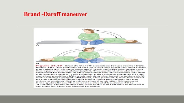 BPPV( Benign Paroxysmal Positional Vertigo) Concept | PPTX | Ear, Nose and Throat Conditions ...