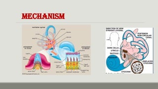 BPPV( Benign Paroxysmal Positional Vertigo) Concept | PPTX