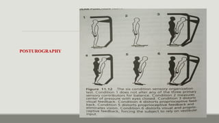 BPPV( Benign Paroxysmal Positional Vertigo) Concept | PPTX