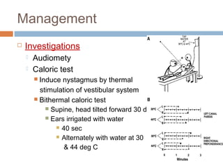 Bppv & vertigo | PPT