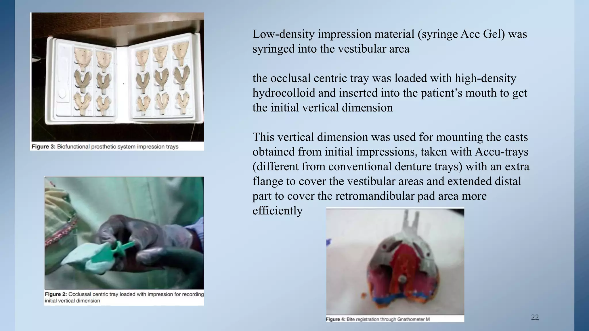 biofunctional prosthetic system | PPTX