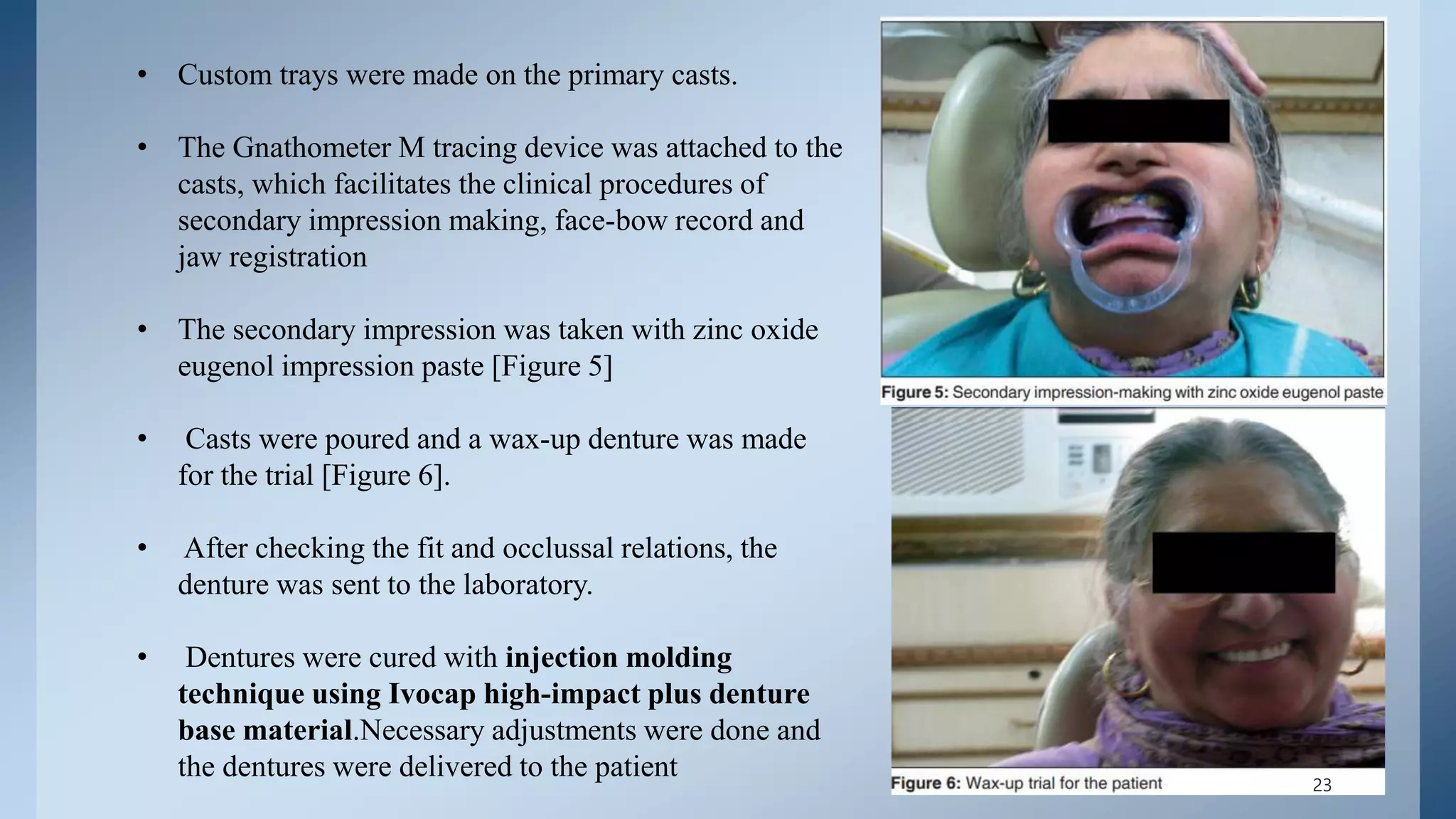 biofunctional prosthetic system | PPTX