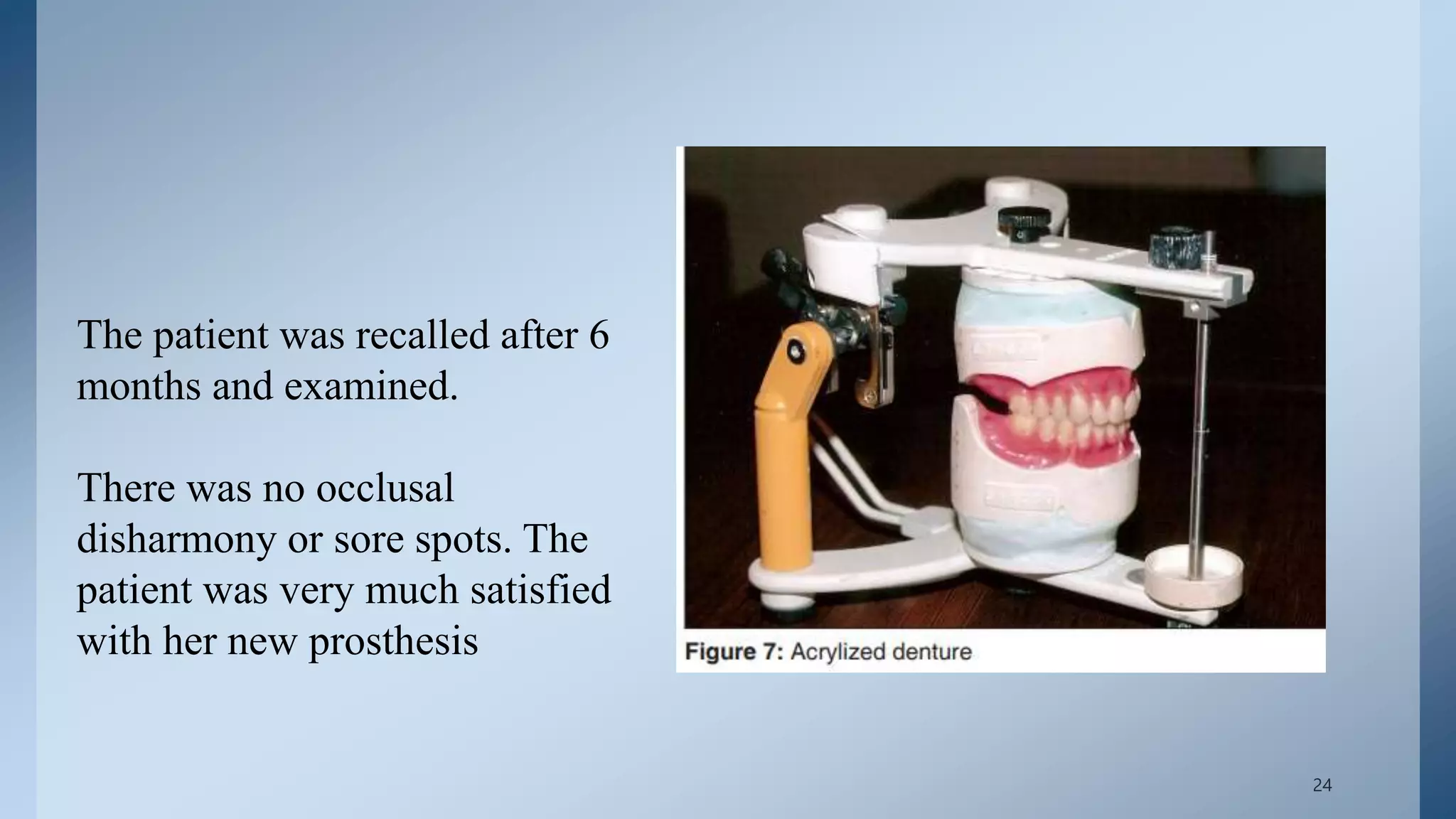 biofunctional prosthetic system | PPTX