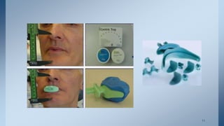 biofunctional prosthetic system | PPTX