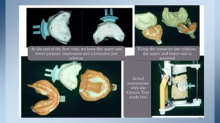 biofunctional prosthetic system | PPTX