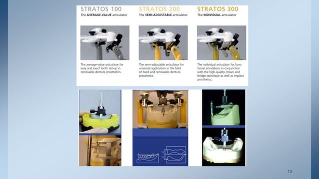 biofunctional prosthetic system | PPTX