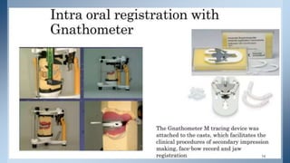 biofunctional prosthetic system | PPTX