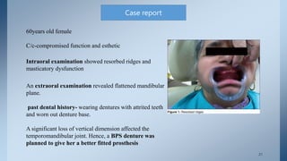 biofunctional prosthetic system | PPTX