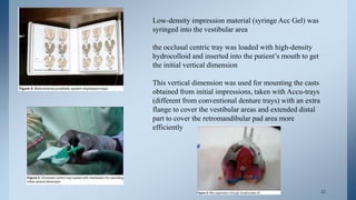 biofunctional prosthetic system | PPTX