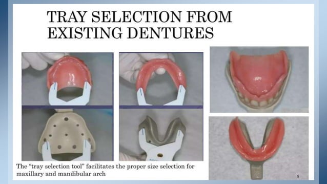 biofunctional prosthetic system | PPTX
