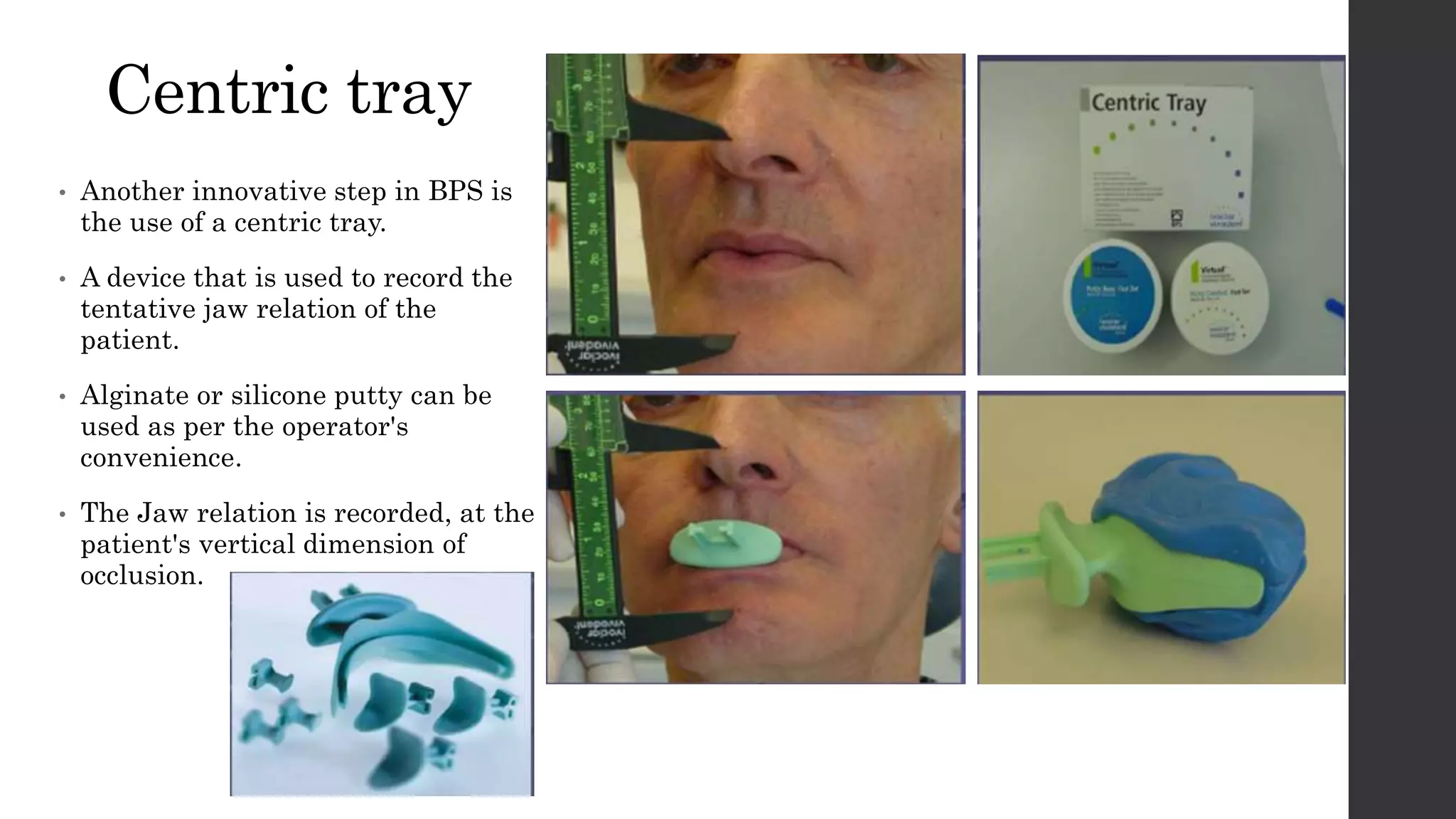 journal cub presentation on Bps denture/biofunctional prosthetic system ...