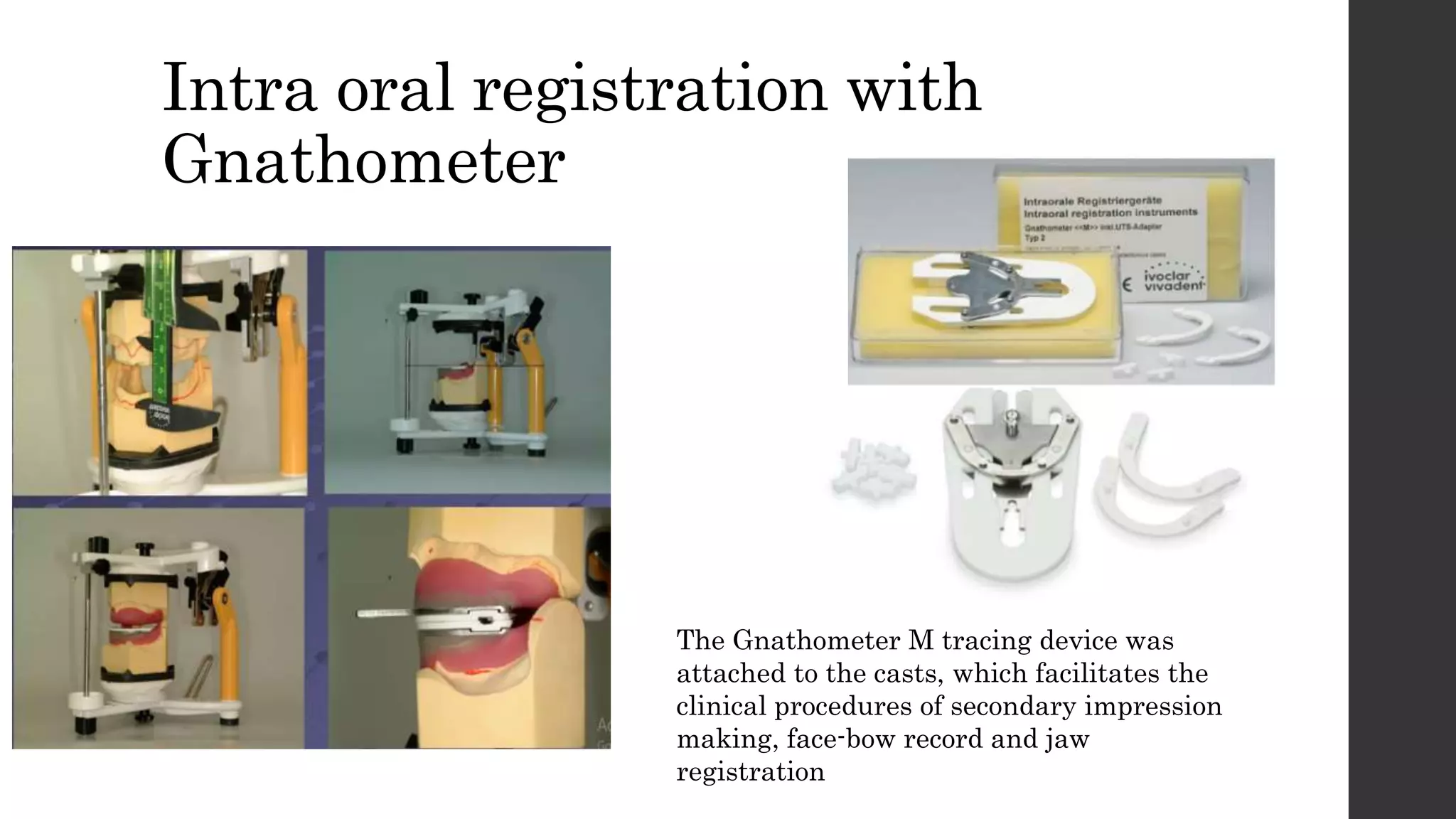 journal cub presentation on Bps denture/biofunctional prosthetic system ...