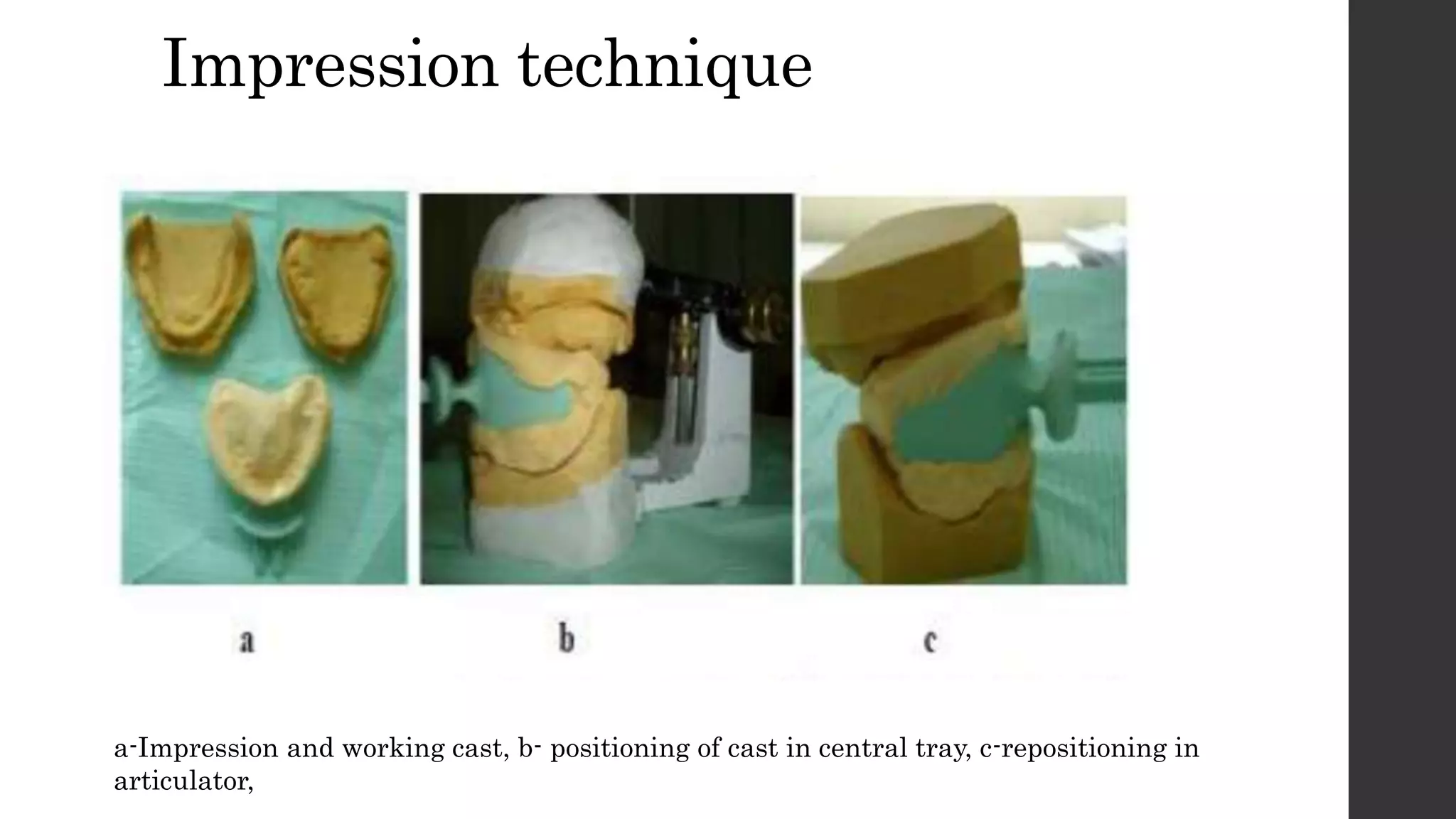 journal cub presentation on Bps denture/biofunctional prosthetic system ...