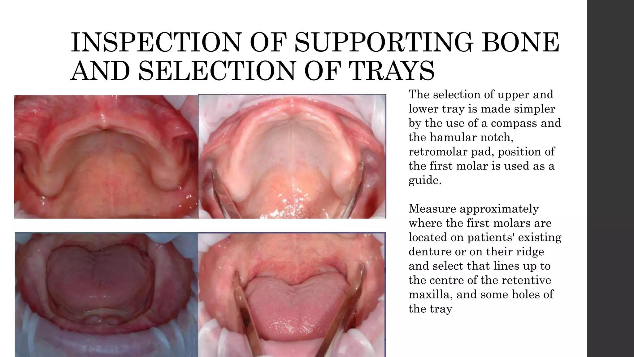 journal cub presentation on Bps denture/biofunctional prosthetic system ...