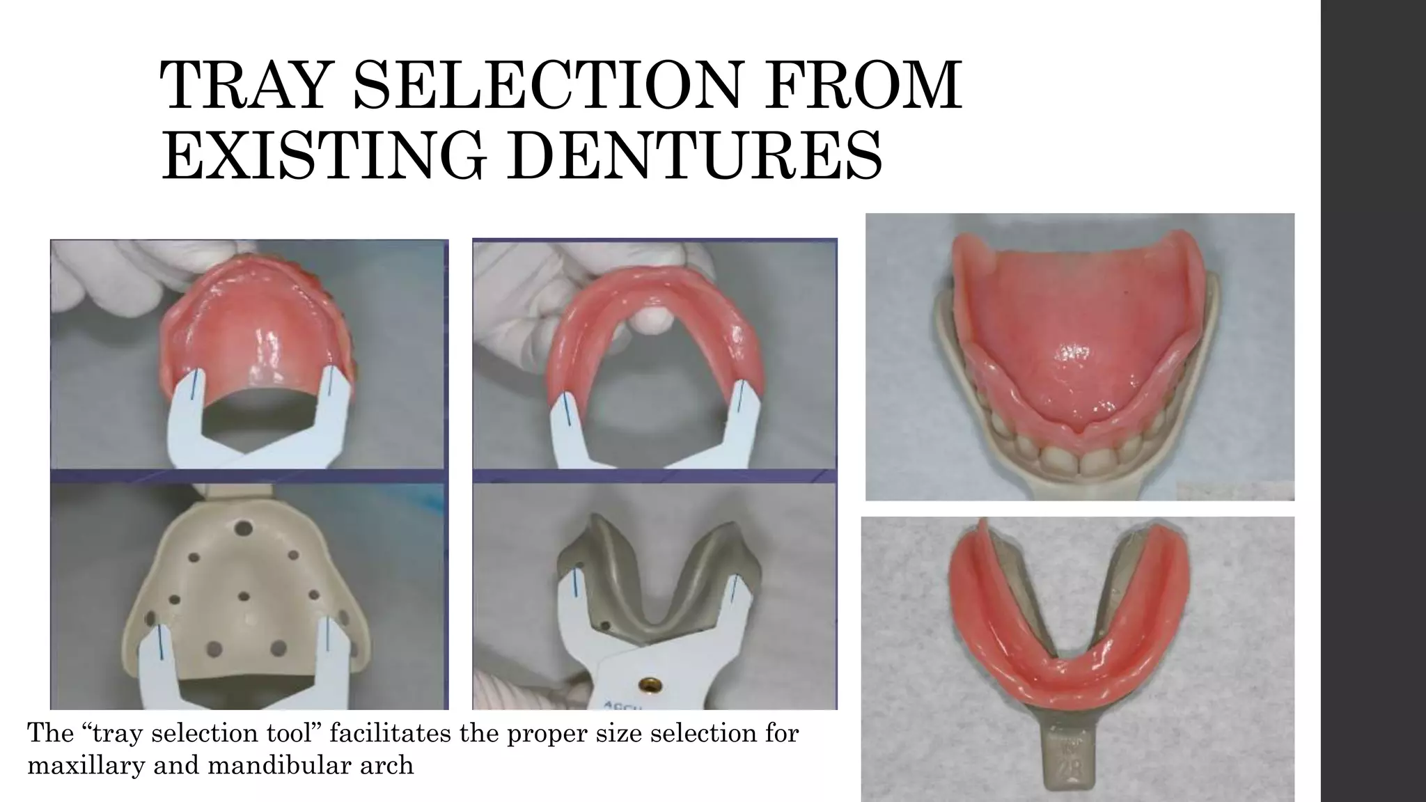 journal cub presentation on Bps denture/biofunctional prosthetic system ...