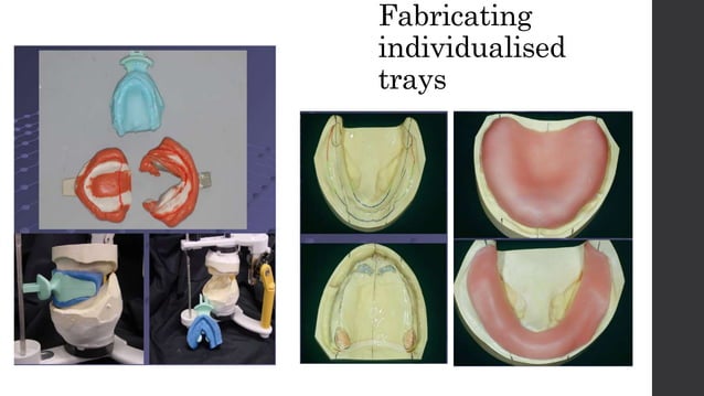 journal cub presentation on Bps denture/biofunctional prosthetic system ...
