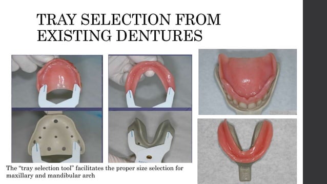 journal cub presentation on Bps denture/biofunctional prosthetic system