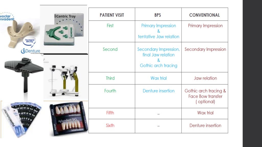 journal cub presentation on Bps denture/biofunctional prosthetic syst…