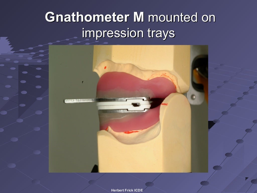 How Dentures are Made - BPS System