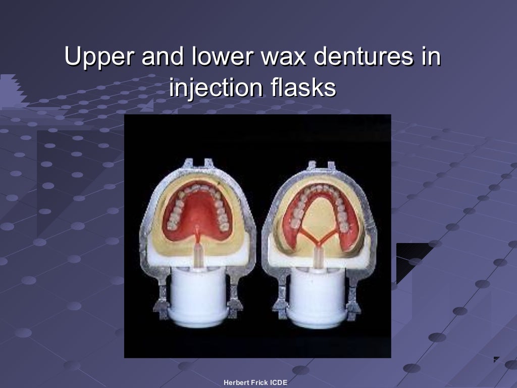 How Dentures are Made - BPS System