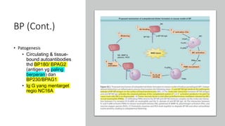 Bp vs eba | PPT