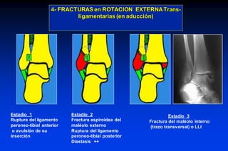 Traumatologia del tobillo | PDF