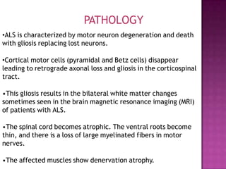 Motor_neuron_disease.ppt