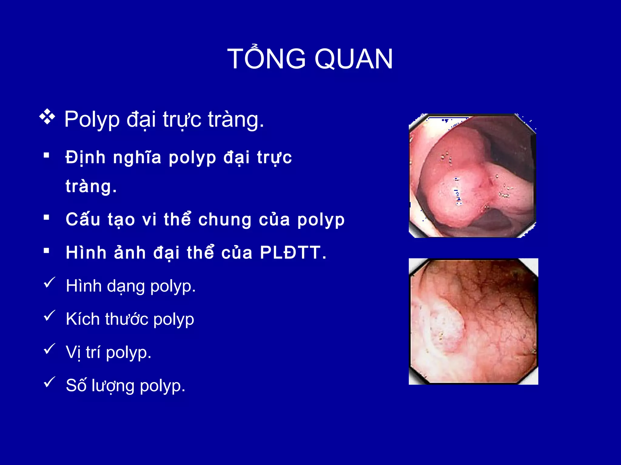 NHẬN XÉT HÌNH ẢNH NỘI SOI, MÔ BỆNH HỌC CỦA POLYP ĐẠI TRỰC TRÀNG VÀ KẾT ...
