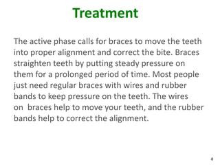 Braces | PPTX