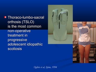 Thoracolumbar braces for the treatment of A.I.S. Is there any ...