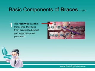 The Facts about Dental Braces | PPTX