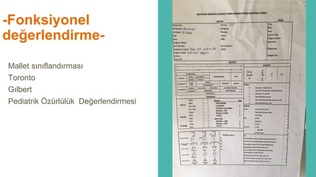 Brachial pleksus | PPTX
