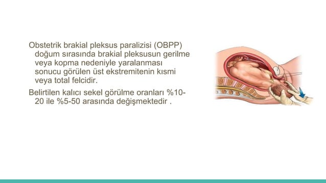 Brachial pleksus | PPTX