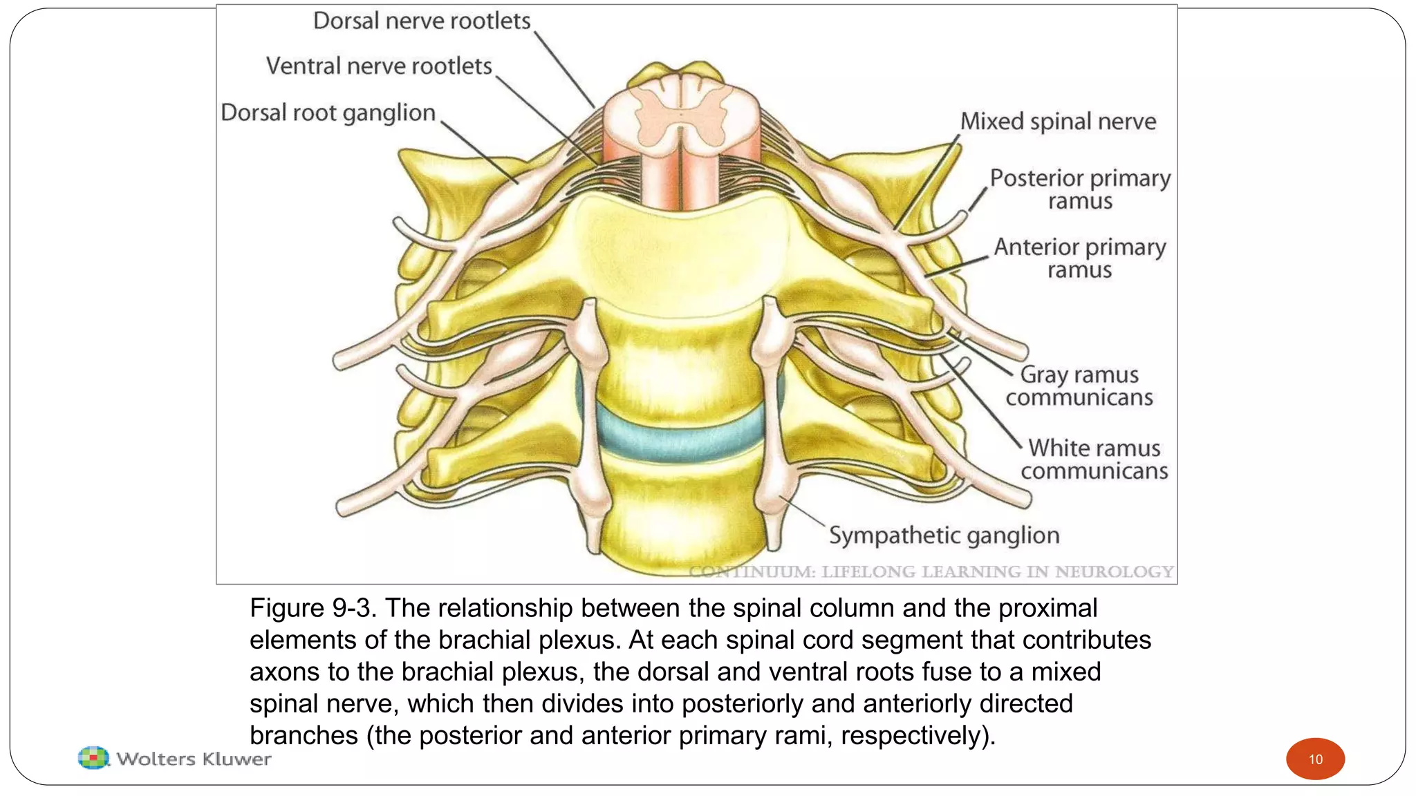 Brachial plexopathies | PPTX