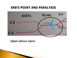 Brachial plexus | PPTX