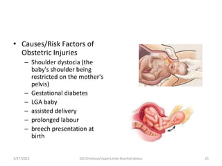 Brachial Plexus -2023.pdf