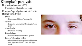 Brachial plexus.pptx
