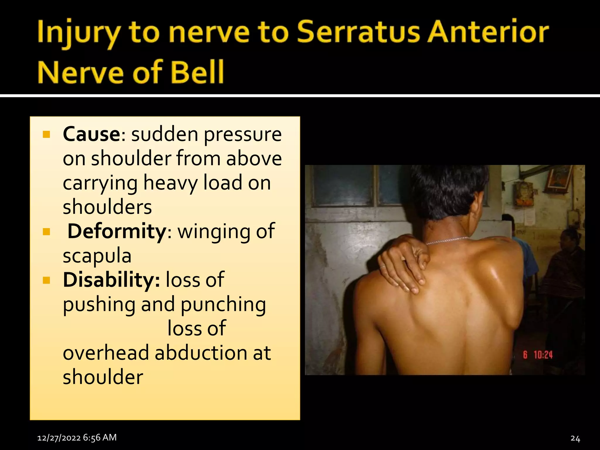 Brachial Plexus.pptx