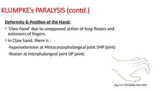 BRACHIAL PLEXUS.pptx Clinical Anatomy .. | PPT