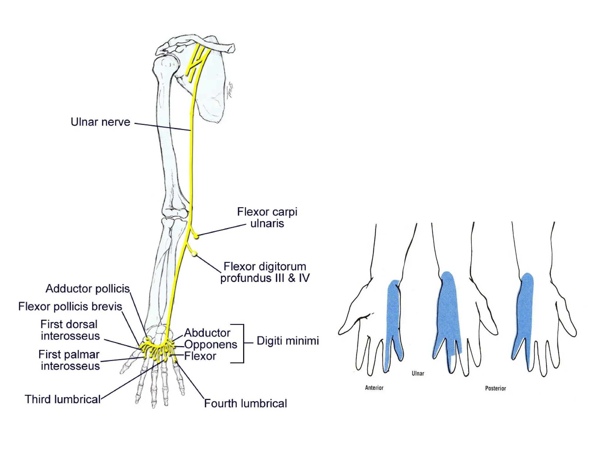 Brachial plexuses presentation by Dr Ela | PPT
