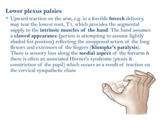 Gross anatomy of brachial Plexus and clinical importance.ppt